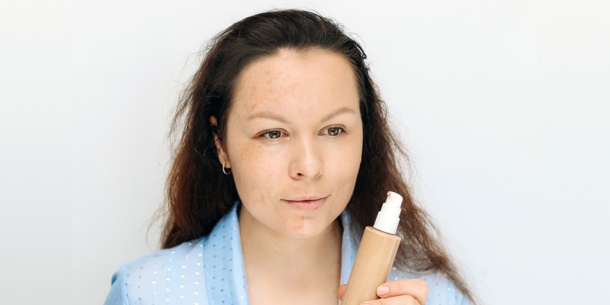 Makeup For Hyperpigmentation In 7 Easy-to-follow Steps