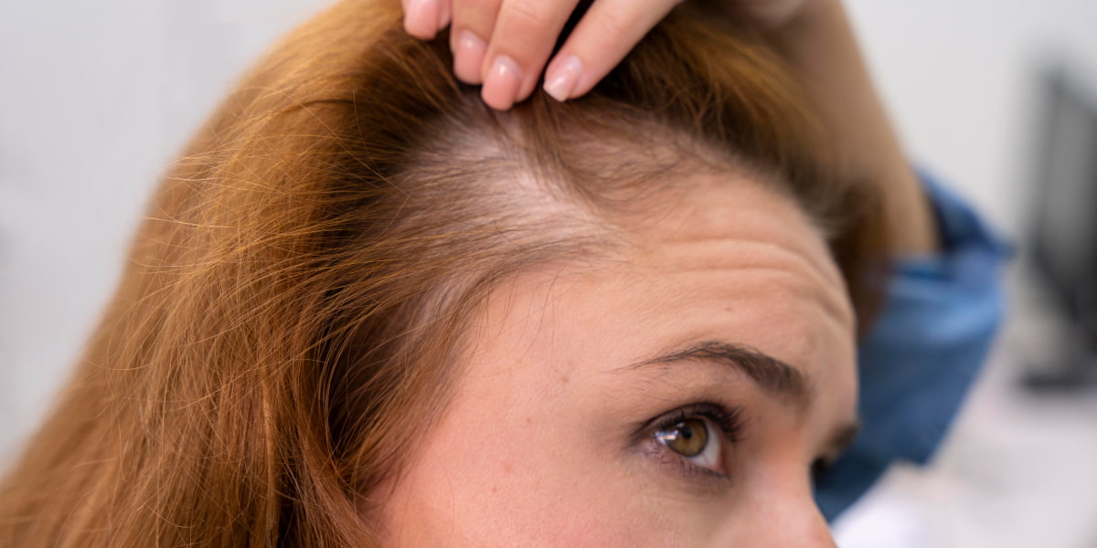 Stop Hair Shedding Immediately! 9 All-proven Methods