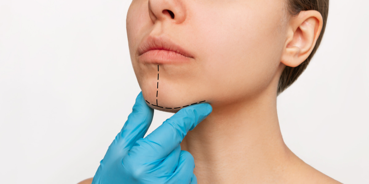 How To Get Rid Of Sagging Jowls: 5 Proven Methods