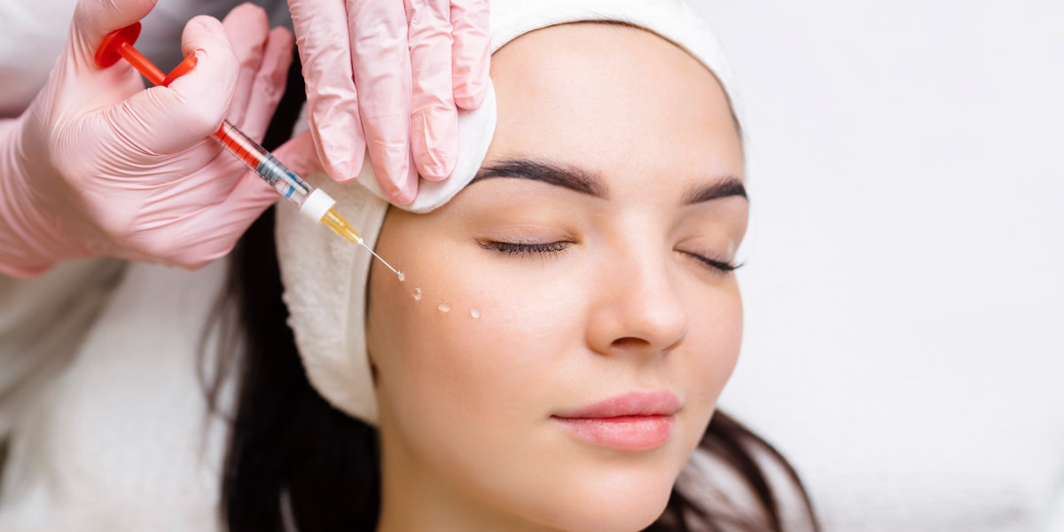 Facial Fillers For Acne Scars: What Should Know