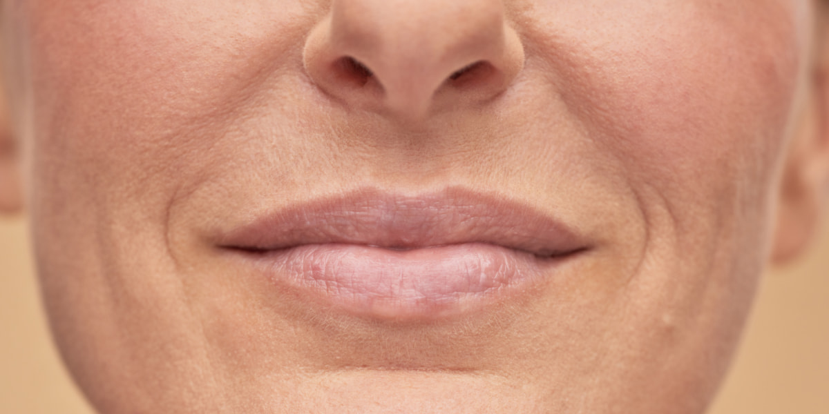 How To Get Rid Of Wrinkles Around The Mouth: Natural Remedies