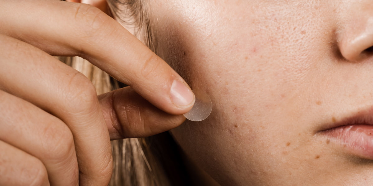 7 Best Pimple Patches to Use in 2023